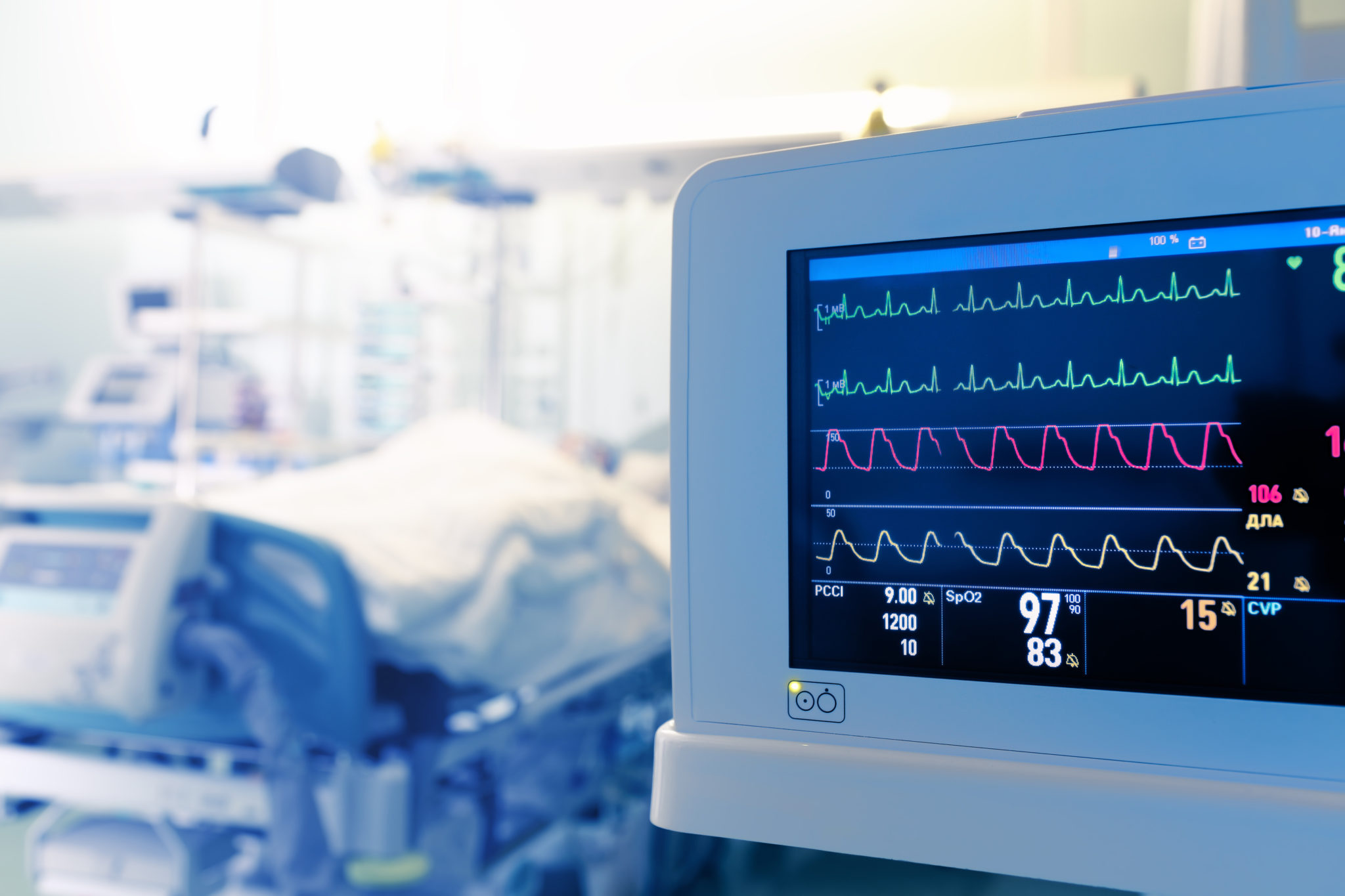 Intensivstation: Interdisziplinäre Versorgung | Elbe-Jeetzel-Klinik